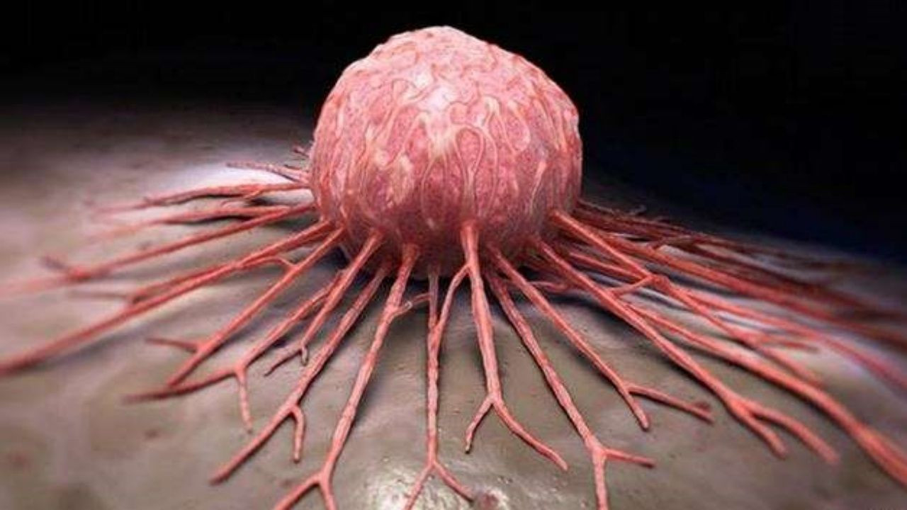 Bu kanser türleri erkeklerde daha sık görülüyor! İşte kanserin ...